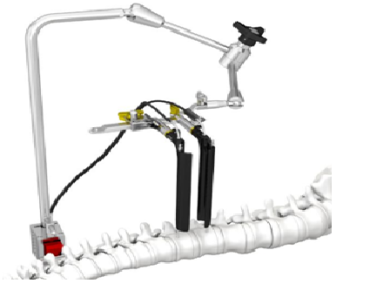 MIS Anterolateral Spine Retractor System - LithosMed